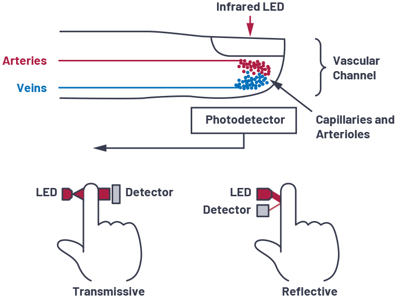 Pulse Oximeter Probe Placement